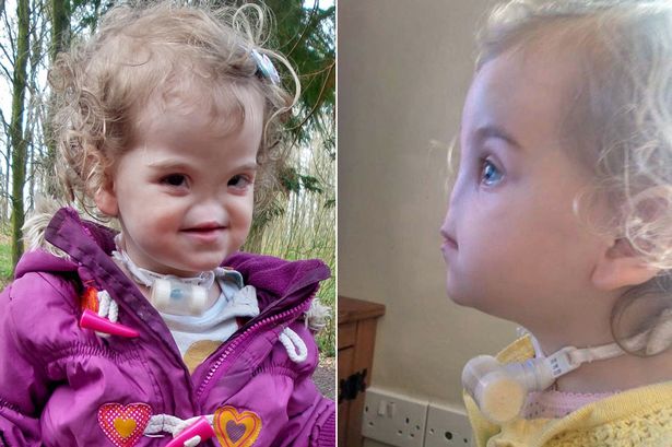 arrinia-congenita_01