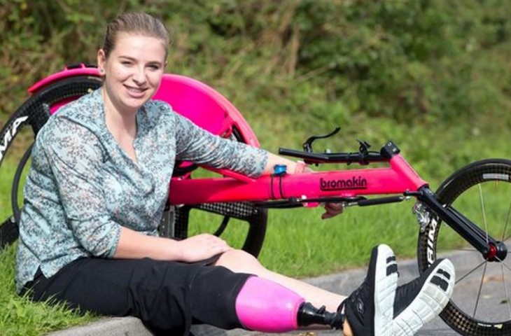 Mulher com condição raríssima tem perna de 100 kg amputada, mas ela ...