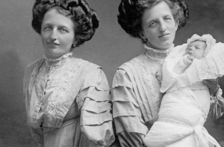 A história de Tatiana e Krista Hogan, as gêmeas siamesas que dividem ...